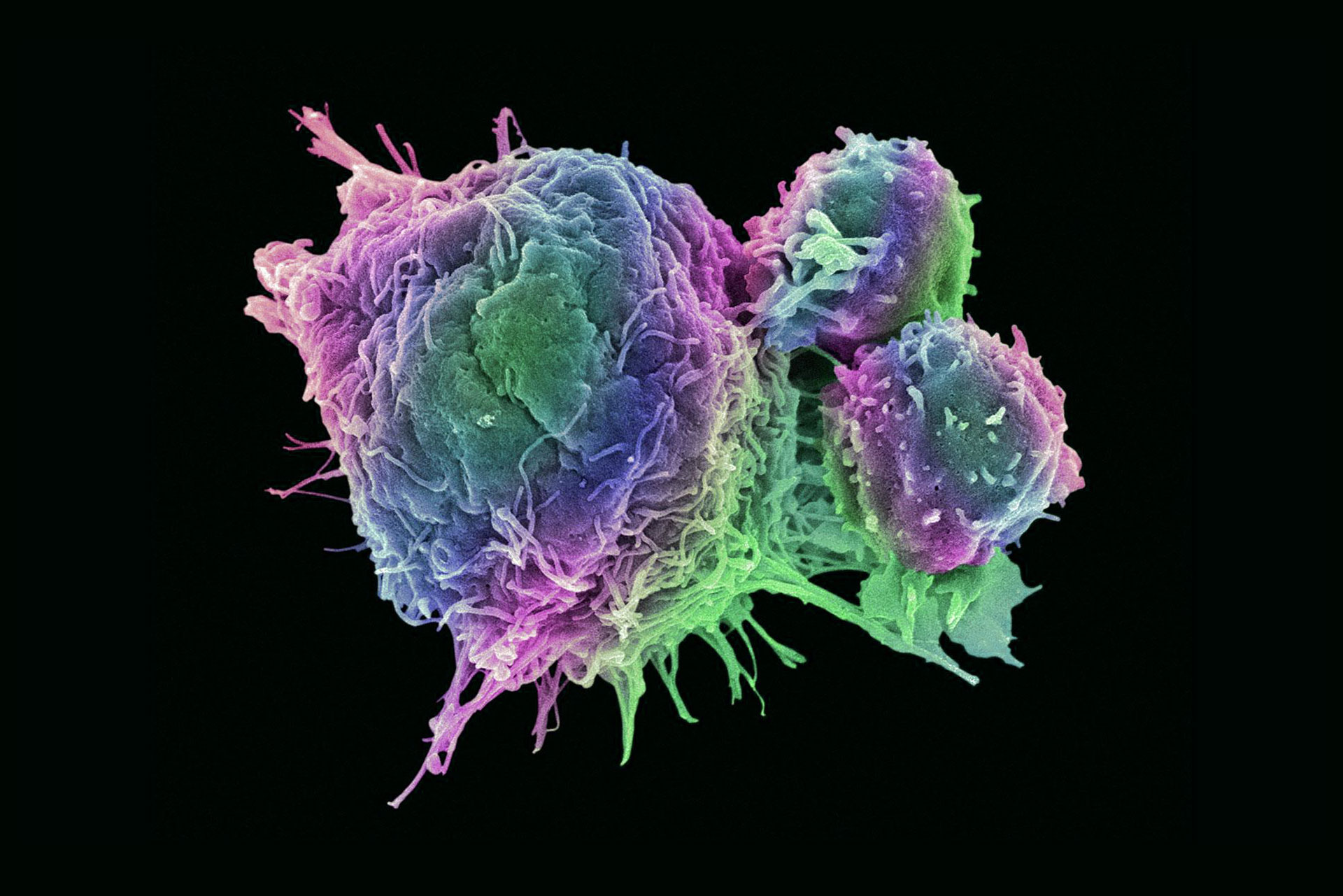 Cancer Therapy Conferences 2020: Radiology, Oncology | Cancer Science ...